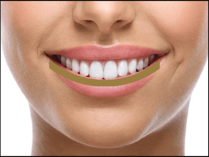 Smile design: the modern approach to dentistry - Kiln Lane Dental